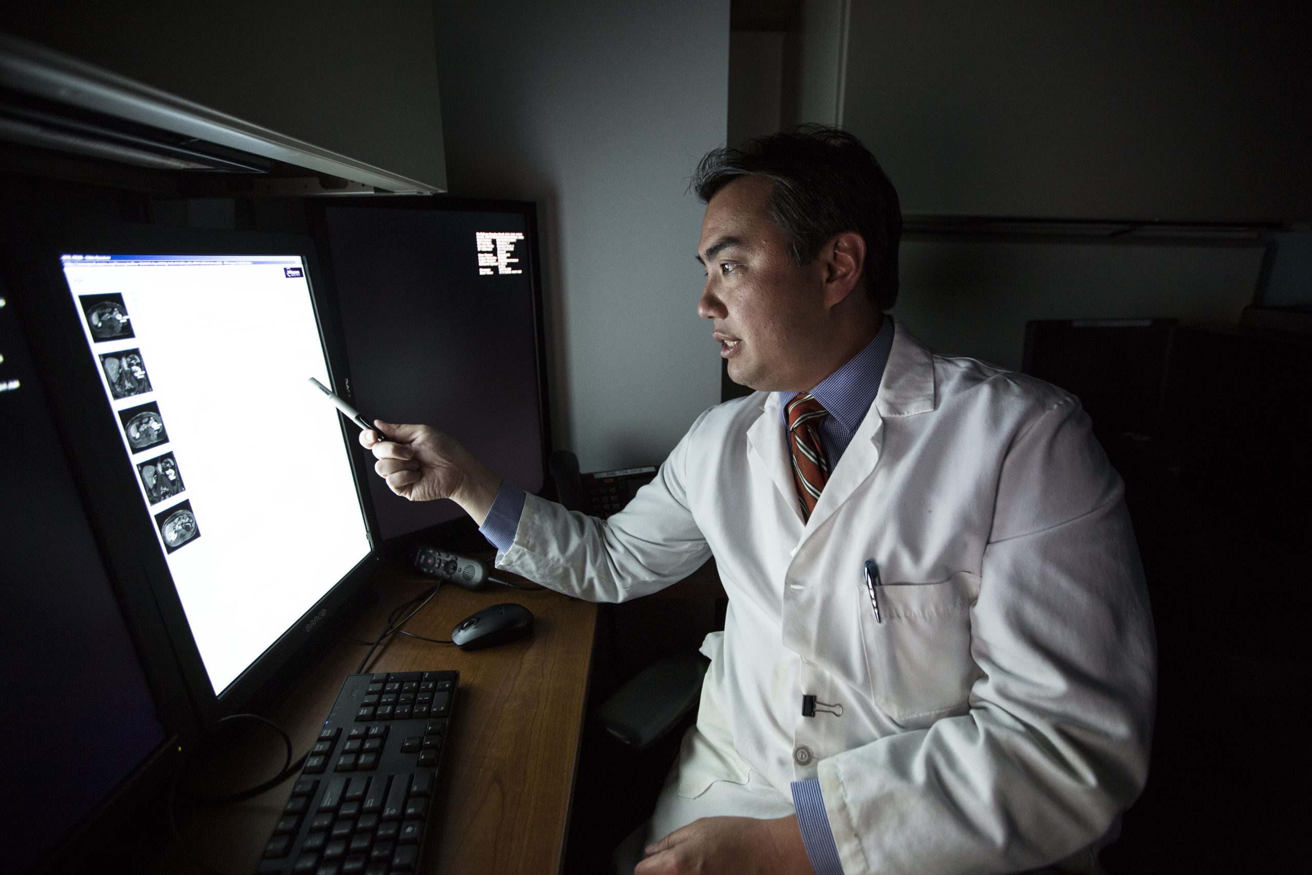 Challenges in Managing Small Renal Masses | NYU Langone Physician Focus